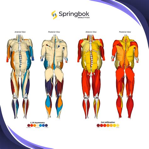 Fshd Global Research Foundation On Linkedin Fshd Muscletechnology Medicalresearch Ai