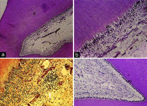 Observation Period 90 Days A Group Cse Rdt 1112 μm Presence Of