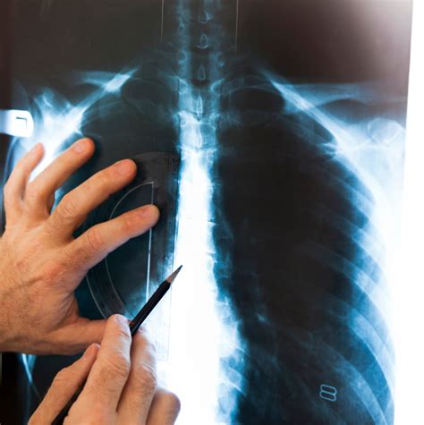 X Ray Core Health Centers Chiropractic Wellness