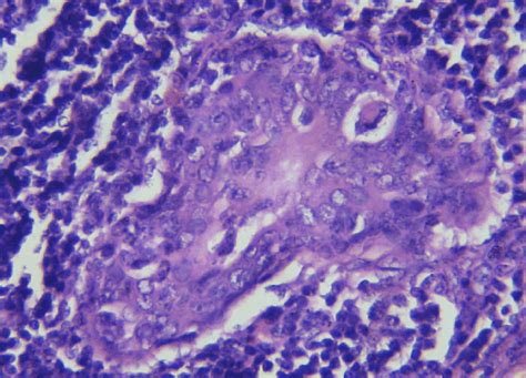 Centrocyte­like Cells Invading Epithelial Structure Forming Download Scientific Diagram