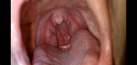 Asian Vore Woman Gagging And Flexing Her Uvula