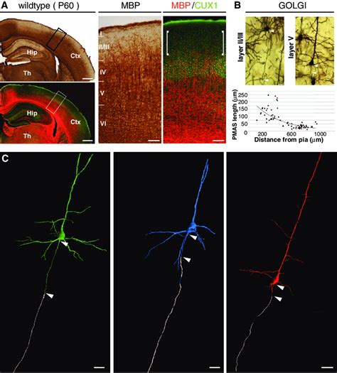 Radial Distribution Of Myelin In The Adult Mouse Neocortex A