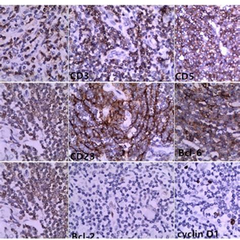 Immunohistochemical Staining For Cd20 Cd3 Cd5 Cd21 Cd23 Bcl 6