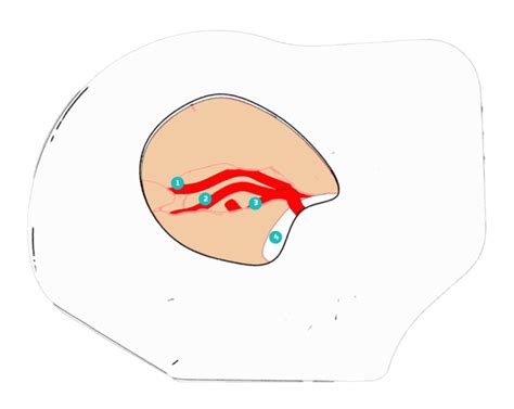 Surgical Simulation Models Aneurysm Clipping Surgeonslab