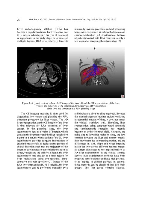 Liver Segmentation On A Variety Of Computed Tomography Ct Images