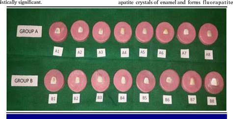 Figure 1 From Comparison Of Remineralizing Effect Of Organic And