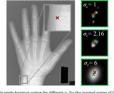 Figure 2 From Integrating Spatial Configuration Into Heatmap Regression