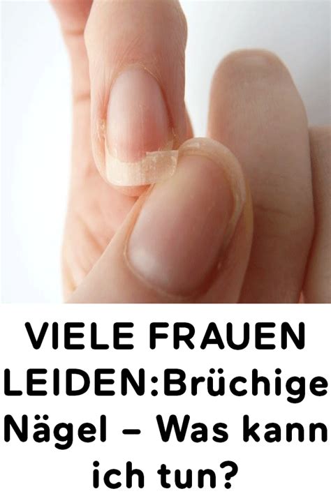 Viele Frauen Leidenbrüchige Nägel — Was Kann Ich Tun Karo