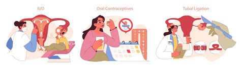 Types Of Contraception Emergency Royalty Free Vector Image