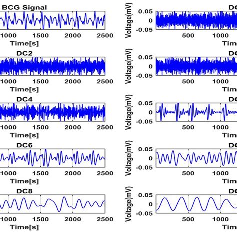 BCG Signal And Its Decomposition Results Download Scientific Diagram