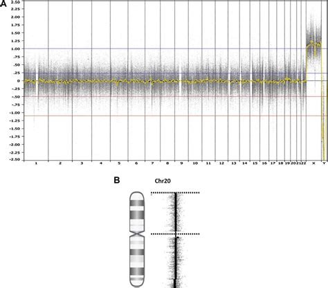Array Comparative Genomic Hybridization On The Dna Extracted From Download Scientific Diagram