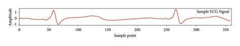A A Sample Ecg Signal And B D Its Dwt Coefficients After The 2nd