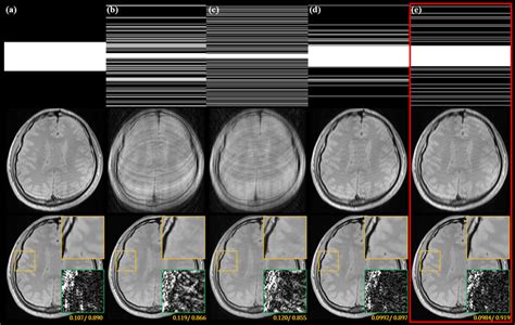 sampling pattern effect for the proposed deep residual learning