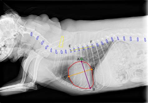 Diagnostic Validation Of Vertebral Heart Score Machine Learning