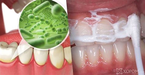 Шүдний эмч эхнэр маань шүдийг ердөө 4 минутын дотор цайруулж шүдний