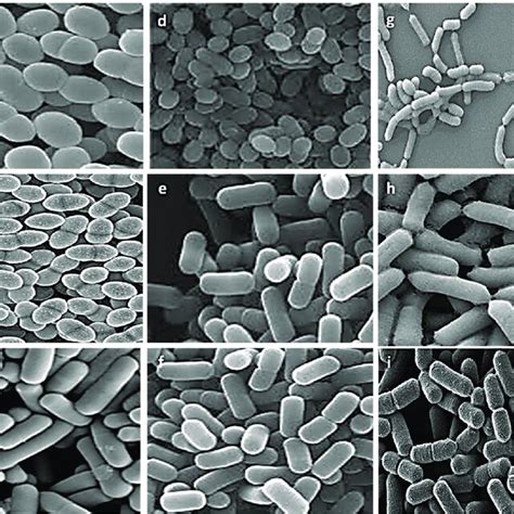 Scanning Electron Microscopy Visualization Of Different Isolates A Download Scientific