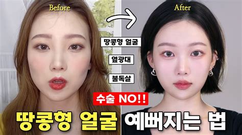 수술 없이 광대 소멸 땅콩형 얼굴 없애는 셀프 경락 마사지🔥 얼굴 작아지는 방법 ️ 땅콩형 얼굴 시술 볼패임 옆광대 불독살 Youtube