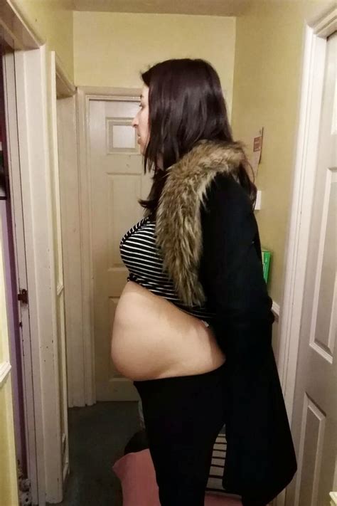 Woman Who Looked Pregnant Actually Had Massive Tumour Removed From Her