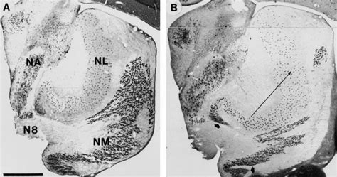 Horizontal Sections Through The Eighth Nerve Cochlear Nuclei And The Download Scientific