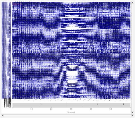 Filtering And Resampling Data — Mne 151 Documentation