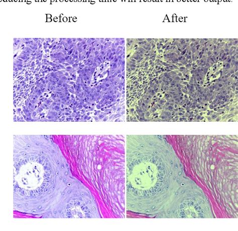 Figure 2 From Deep Learning Techniques For The Detection And Classification Of Oral Cancer Using