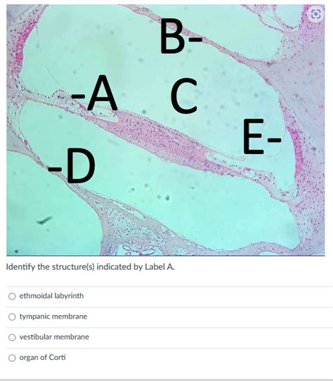 Solved The Structure S Indicated By Label A Contains Chegg Com