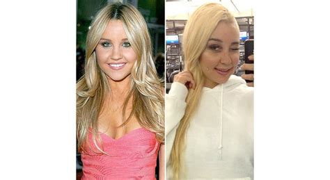 60 Worst Cases Of Celebrity Plastic Surgery Gone Wrong