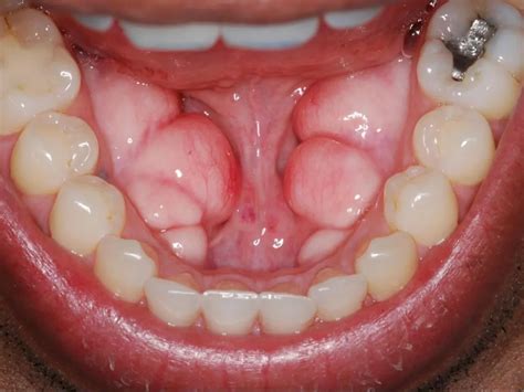 Align Dental Care