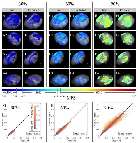 Real Time Brain Strain Calculation And Visualization Using Deep