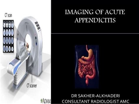 Imaging Of Acute Appendicitis