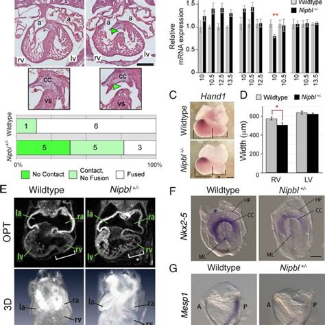 Nipbl Flex And Nipbl Mice Develop Heart Defects At The Same High