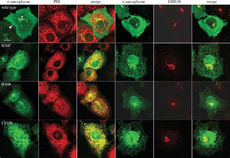 Intracellular Retention Of 1 Sarcoglycan Mutants In Cos 7 Cells Cells