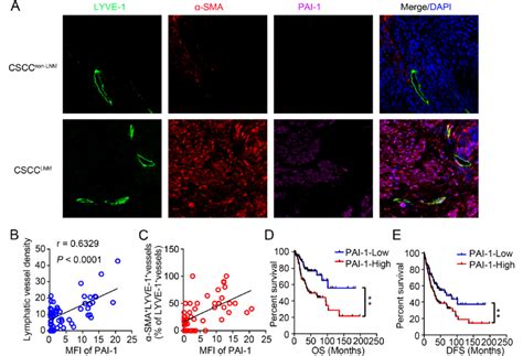 Pai 1 Drives Endomt And Aberrant Lymphangiogenesis And Correlates With