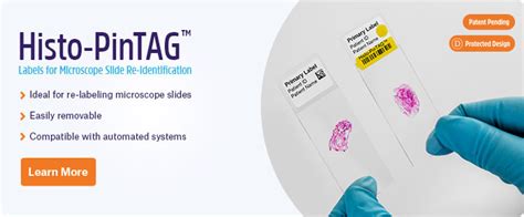 How To Optimize The Re Identification Of Histology Slides For Pathology