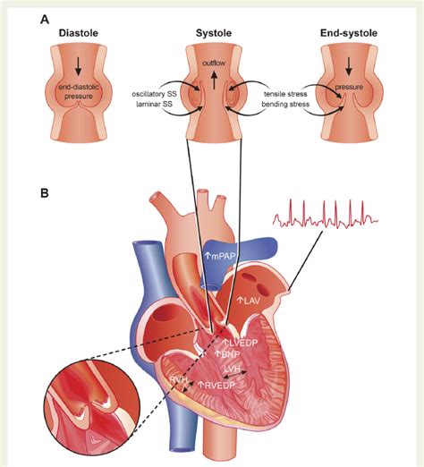 Hemodynamic Flow Across The Aortic Valve And Myocardial Alterations Download Scientific Diagram
