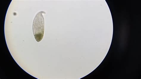 Could Anyone Help Me Identify This R Microscopy