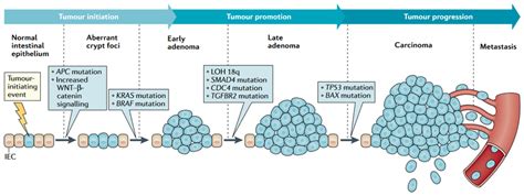 Mécanismes Dinitiation Et De Progression Tumorale Du Cancer Colorectal
