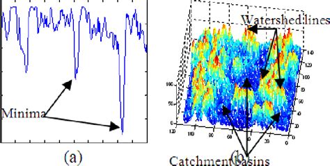 Figure 1 From Trabecular Bone Image Segmentation Using Iterative