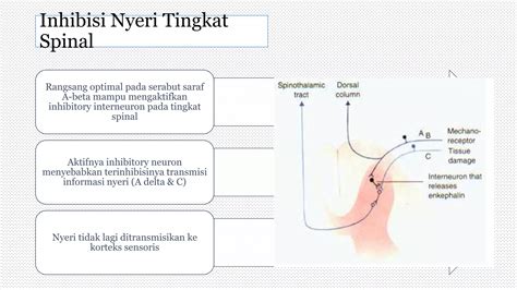 2 Interferential Current Pptx