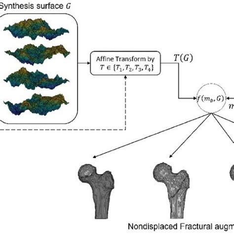 Workflow Of The Fractural Augmentation The Position Of The Synthesis Download Scientific