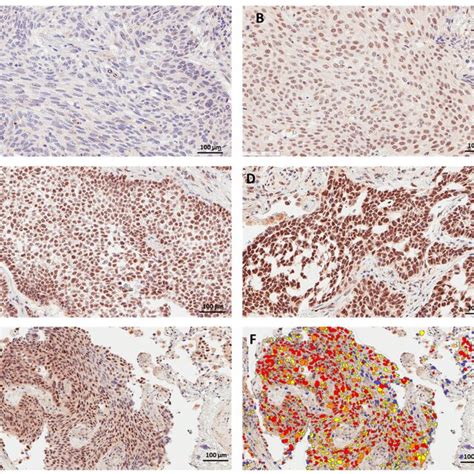 Image Analysis Workflow For Ihc Staining Quantification A D G Are Download Scientific
