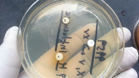 Microbial Diagnostic Disks Introduction List Of Disks Uses And