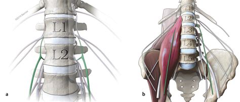 Minimally Invasive Lateral Transpsoas Interbody Lumbar Fusion Neupsy Key