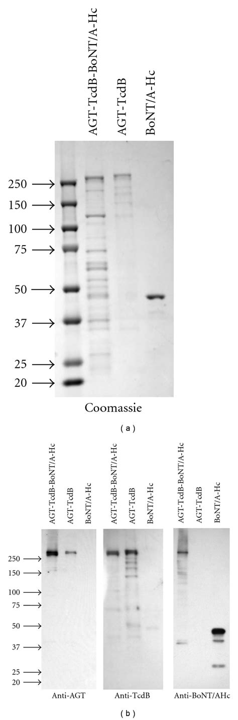 Recombinant Expression Of Tcdb With A Bonta Rbd Recombinant Agt Tcdb Download Scientific