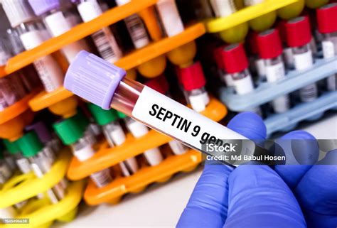 Sampel Darah Untuk Tes Gen Septin 9 Tes Biopsi Cair Untuk Mendeteksi