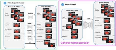 spinal cord segmentation generalizable across datasets