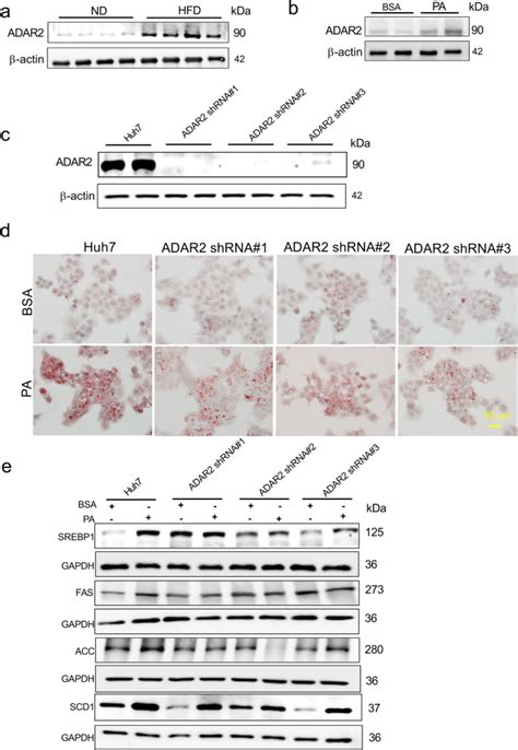 Adar2 缺乏通过 Ampk 信号通路改善肥胖小鼠的代谢相关脂肪肝 Communications Biology X Mol