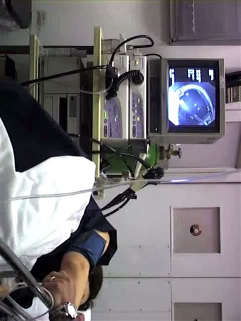 Colonoscopy Karaoke Thisvid Com