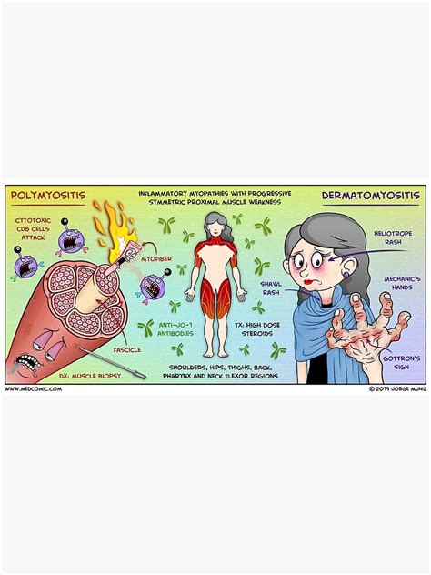 Polymyositis Vs Dermatomyositis Art Print For Sale By Medcomic Redbubble