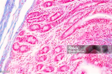Backgrounds Of Characteristics Tissue Of Jejunum Human Under Microscope